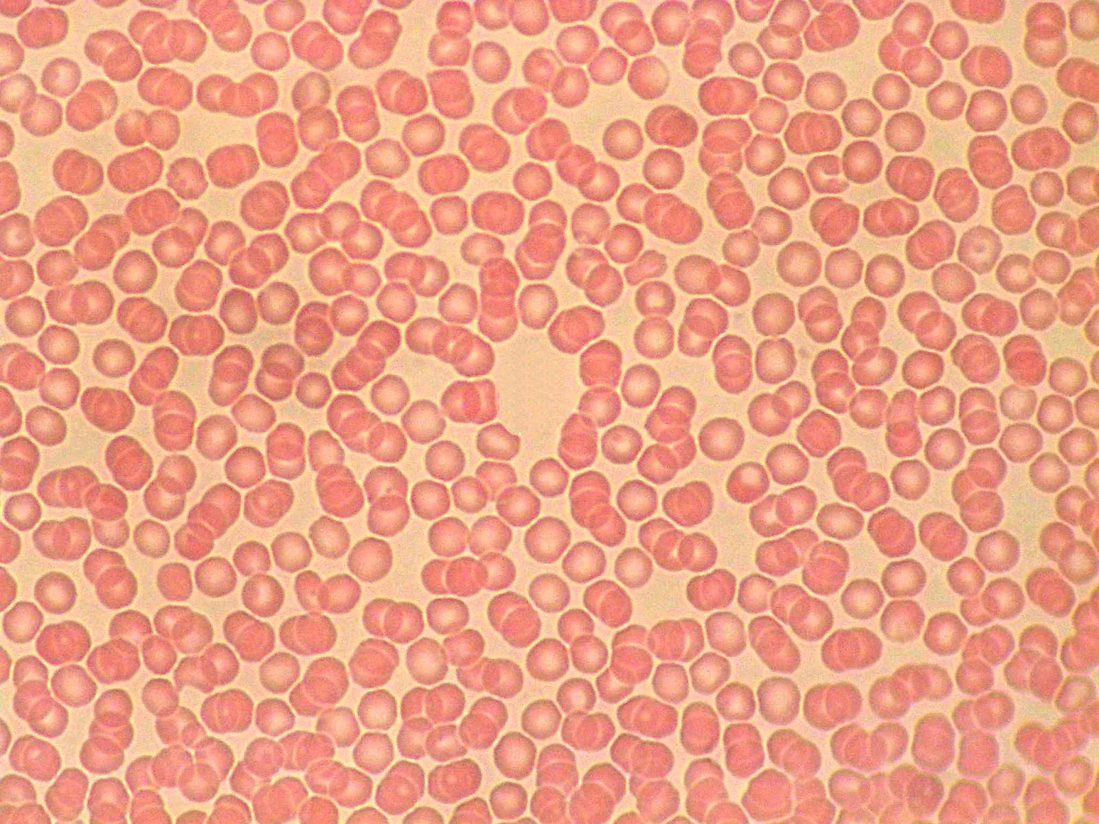 Hematología