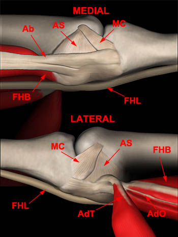 MRI Musculo-Skeletal Section: Turf toe.