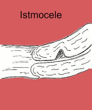 Endoscopia Ginecologica