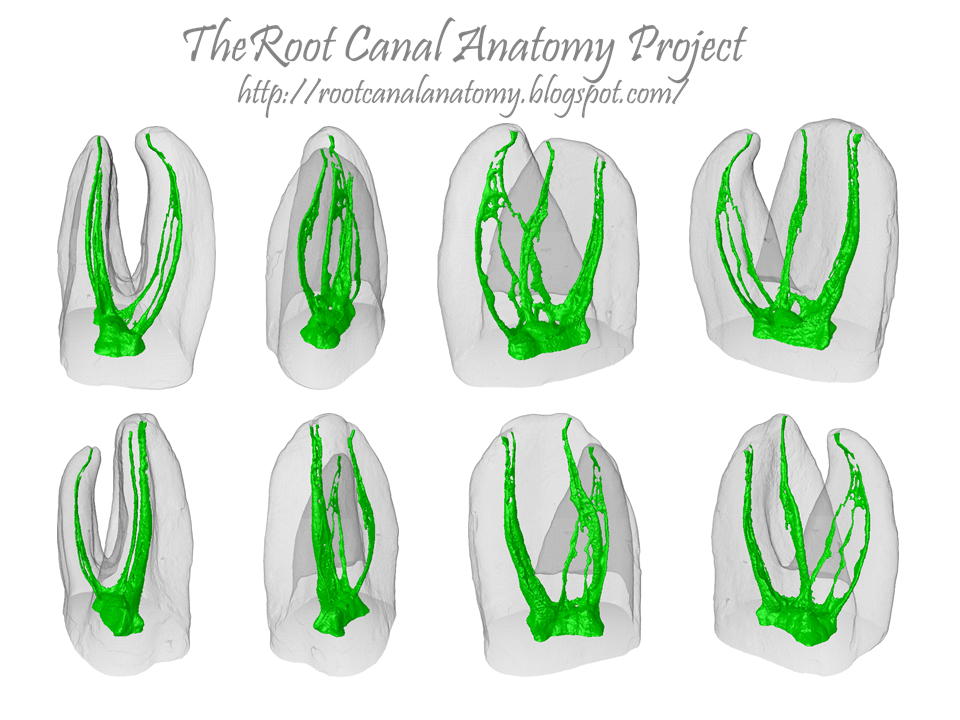 The Root Canal Anatomy Project March 2013