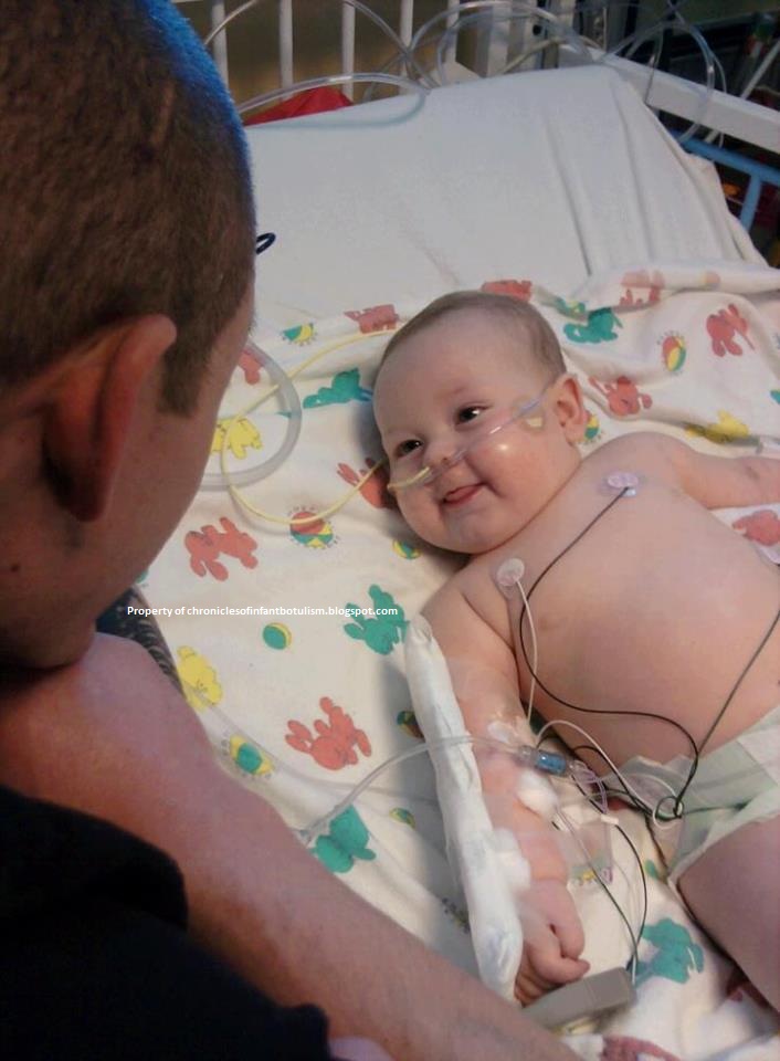 Chronicles of Infant Botulism: Baby T's Story, Chapter 13- Extubated ...