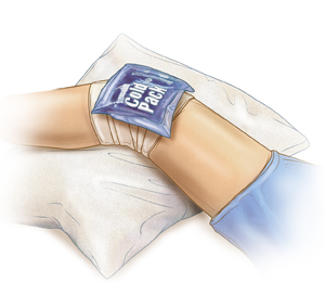 Fisioterapia: 10 Razones: No más método R.I.C.E. en Fisioterapia y ...