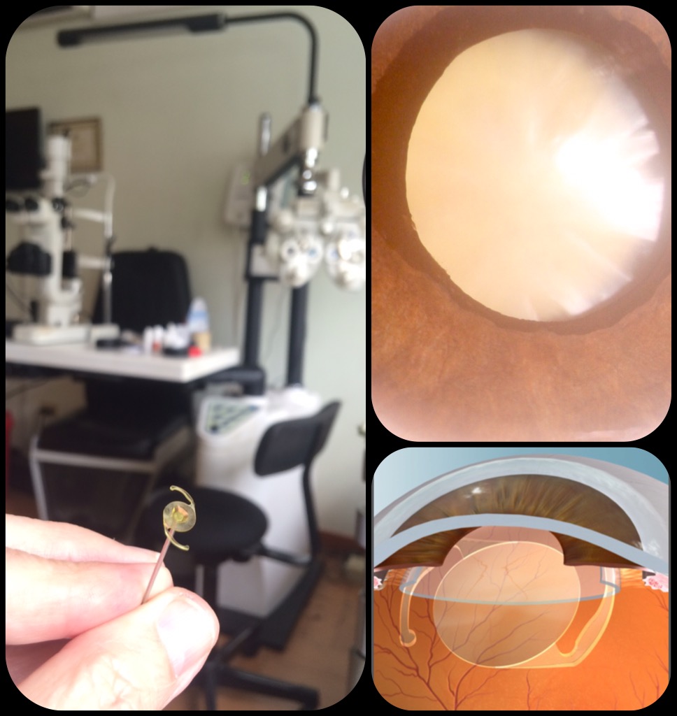 Blog del Oftalmólogo en Guayaquil