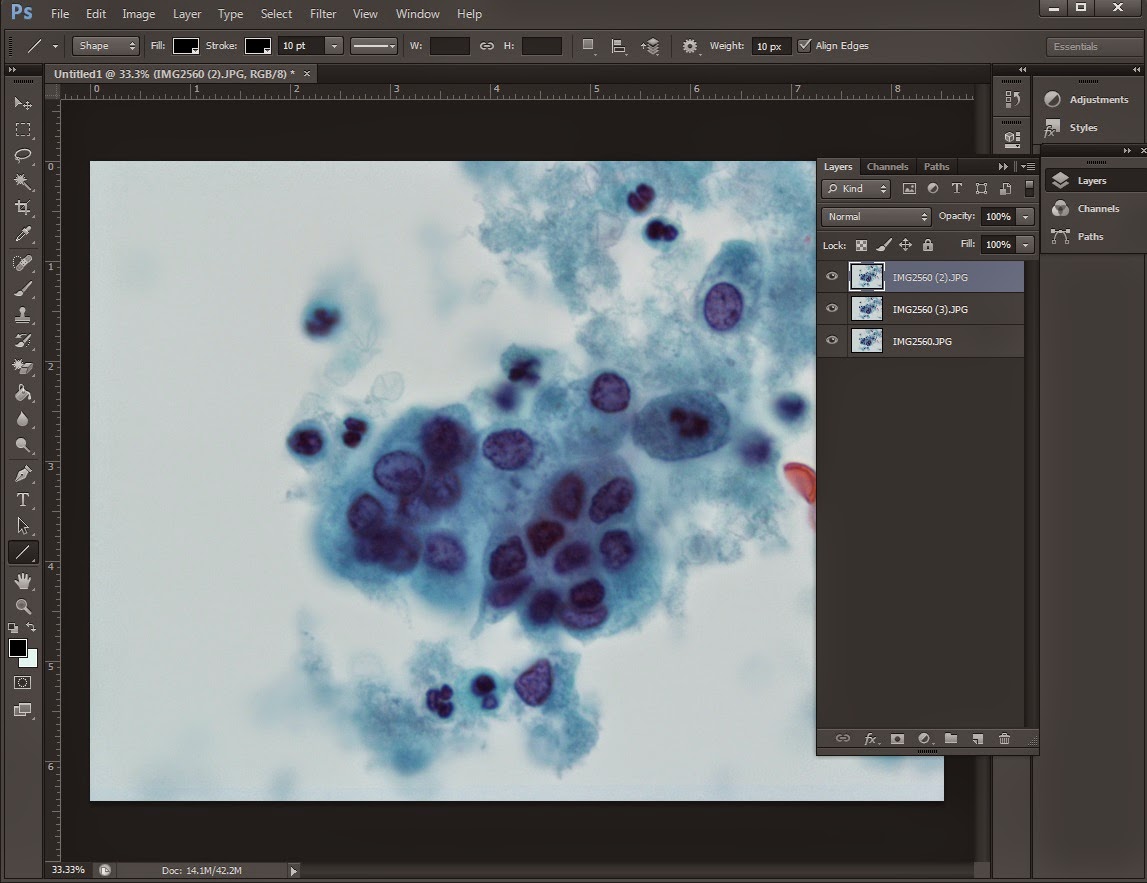 Pathology photography techniques