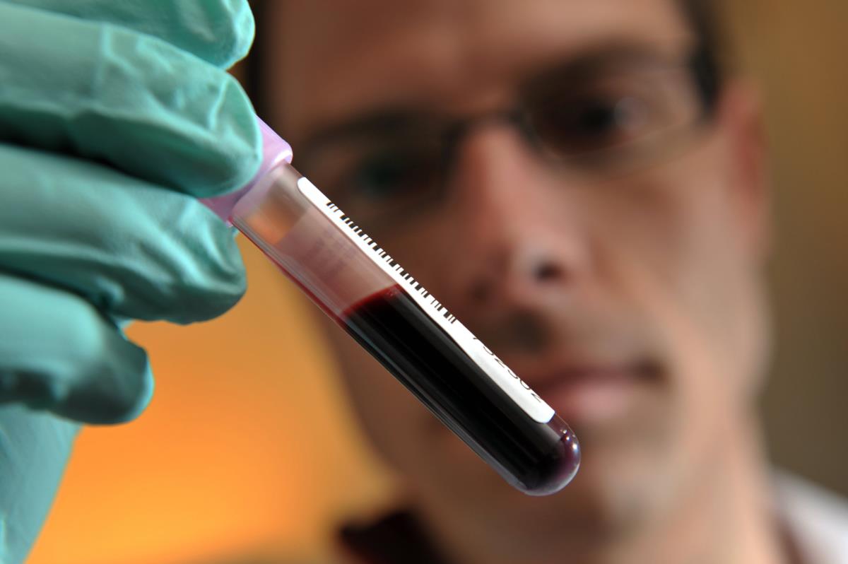 Doping en el Deporte: CUANTOS TIPOS DE CONTROLES DE DOPAJE EXISTEN Doping en el Deporte: CUANTOS TIPOS DE CONTROLES DE DOPAJE EXISTEN