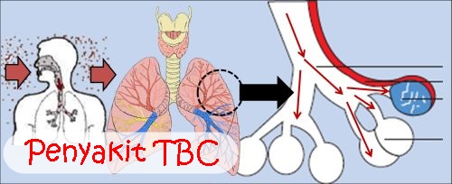 Berapa lama penyembuhan tb paru | Obat Batuk Tradisional