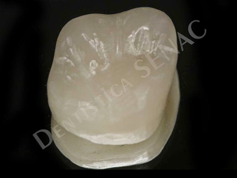 Dentística no SENAC: CEREC 3
