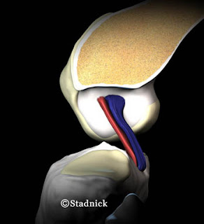 Radiology Channel: Anatomy of bundles of ACL and PCL.