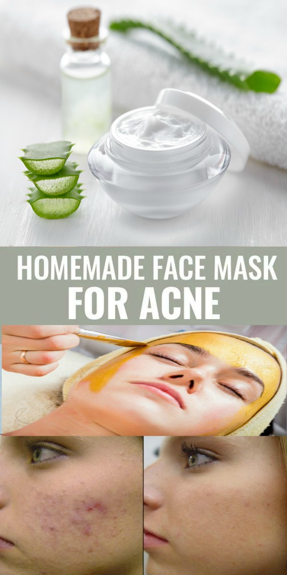 Health+Beauty: HOMEMADE FACE MASK FOR ACNE