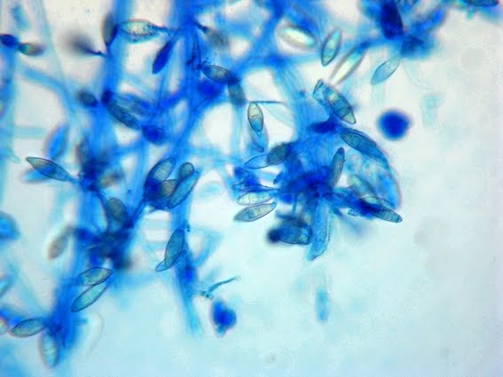 Fun With Microbiology (What's Buggin' You?): Microsporum canis
