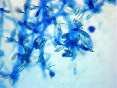 Fun With Microbiology (What's Buggin' You?): Microsporum canis