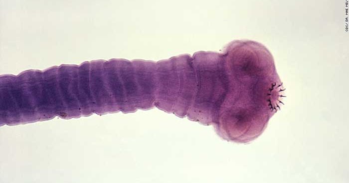 The worms that invade your brain! | Interesting Facts