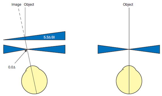 Eye 2 Eye Optometrists: Prism and Progressive Lenses