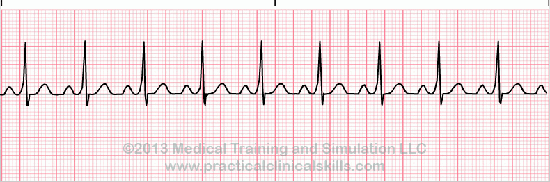 ER goldbook: EKG interpretation