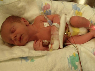 The Premature Parent