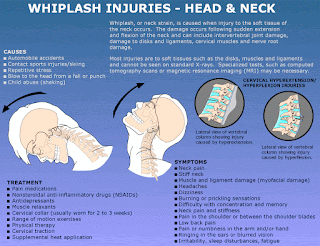Whiplash Injury