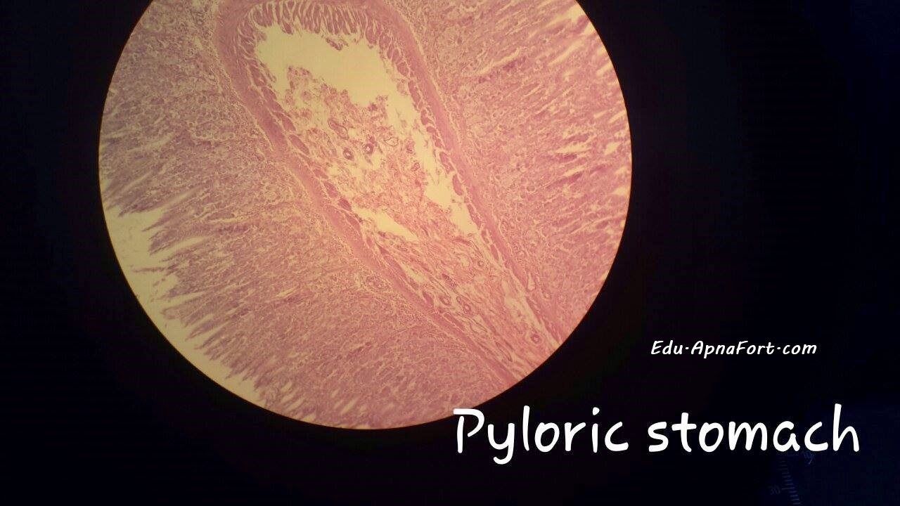 Educational Blog : Stomach-Pylorus slides