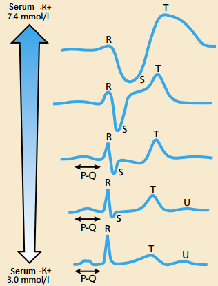 Water - the best of diuretics | MY HEALTH LEGACY