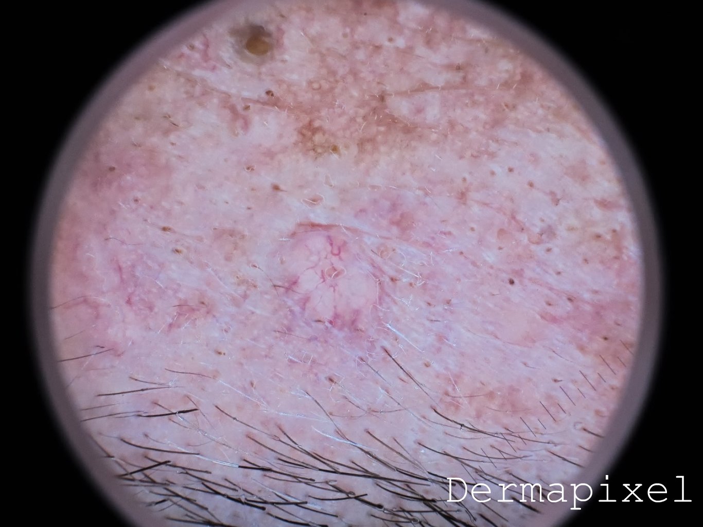 Dermapixel: julio 2013