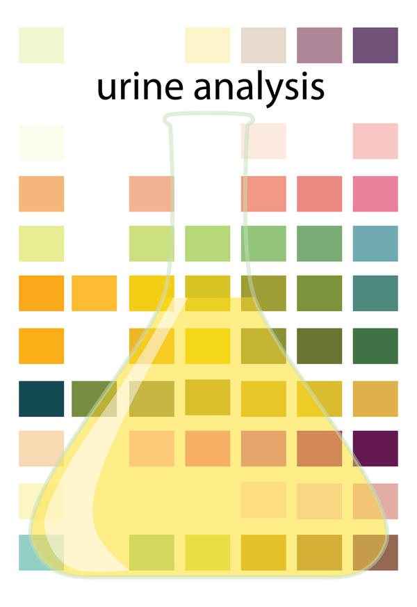 Cara Mudah Cek Kondisi Kesehatan Dari Warna Urine | YULITA AMELIA