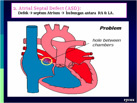 SISTEM KARDIOVASKULER 1 & 2 : Congenital Heart Disease (CHD)