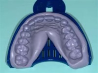 Dentistry and Medicine: Clinical stages in Removable partial denture ...