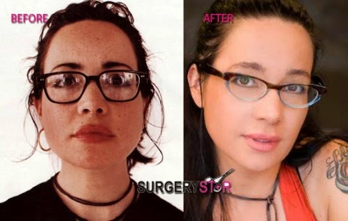 Janeane Garofalo Plastic Surgery Before And After