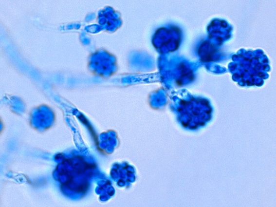 Fun With Microbiology (What's Buggin' You?): Trichoderma species