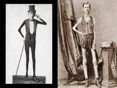 MANUSIA TERKURUS: Orang Terkurus Di Dunia