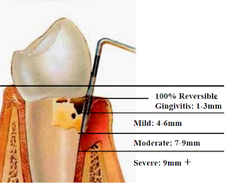VeggiePharm: Oil Pulling with Sesame Oil: Before and After Bacterial ...
