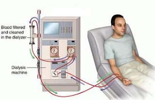 treatment for kidney disease: What Are the Side Effects of Long-Term ...