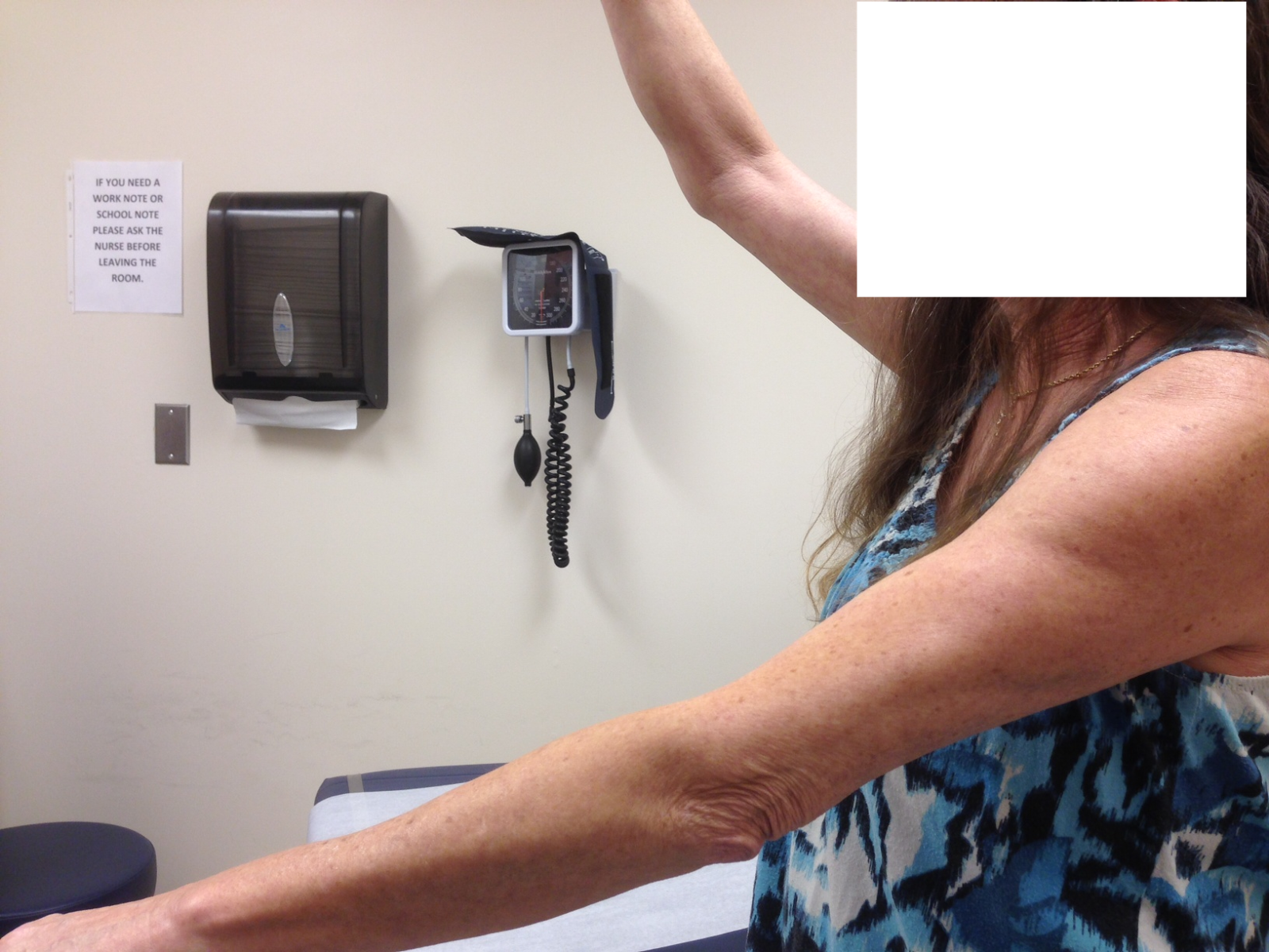 Shoulder and Elbow Surgery: Reverse shoulder replacement for severe ...