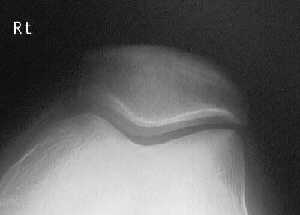 ABC Radiology Blog: Knee Joint