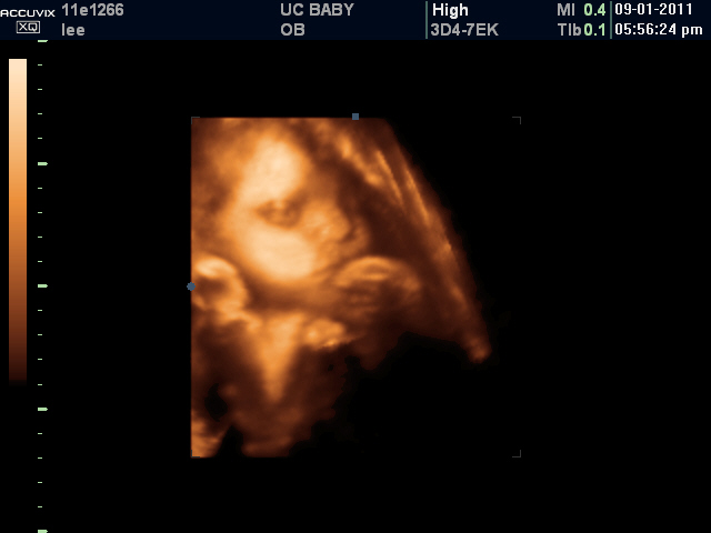 Kate & Nate: Parents In Waiting: 3D Ultrasound - 26 Weeks & 29 Weeks