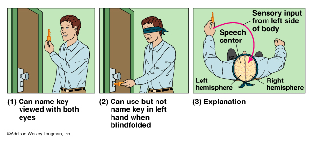Biological Psychology: Split Brain