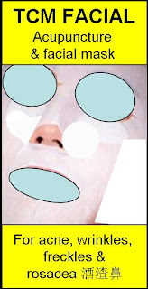 TCM News: TCM Physician Facial Treatment for Acne, Freckles, Wrinkles ...