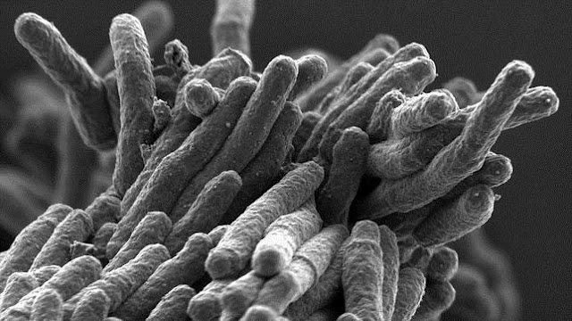 Prisma Gótico: Tuberculosis. Un castigo de la época.