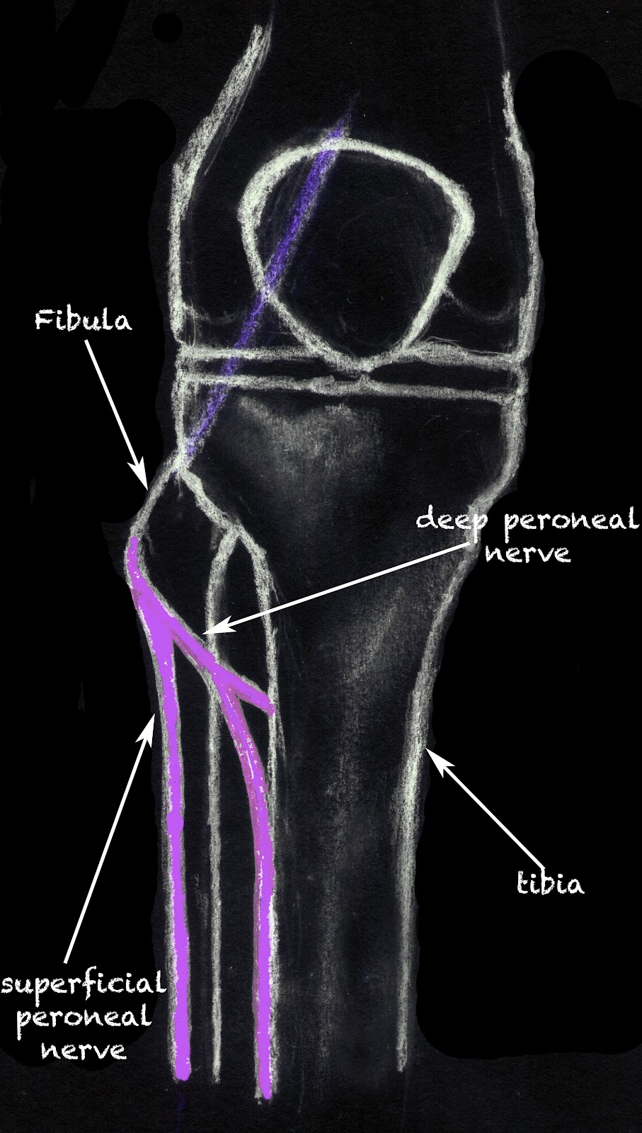 Exercise Basics: Sciatica Part 1 - Anatomy