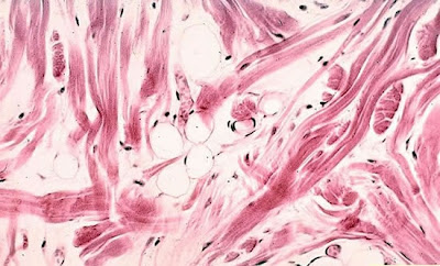 Tejido Conjuntivo Adulto