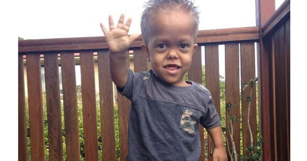 ¿Que es la Acondroplasia o Enanismo?