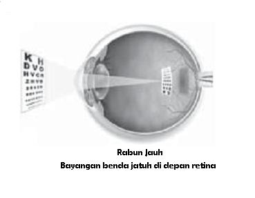 Yuk, Belajar Tentang Alat-Alat Optik