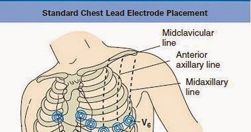 Medical Laboratory and Biomedical Science: ECG chest leads