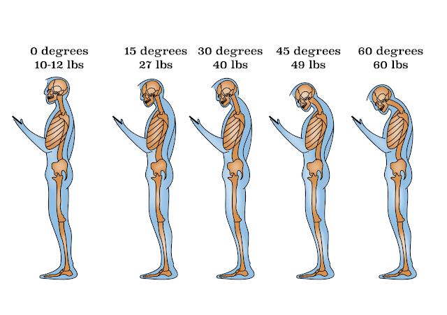 Text Neck, Forward Head Posture, and What to Do About It