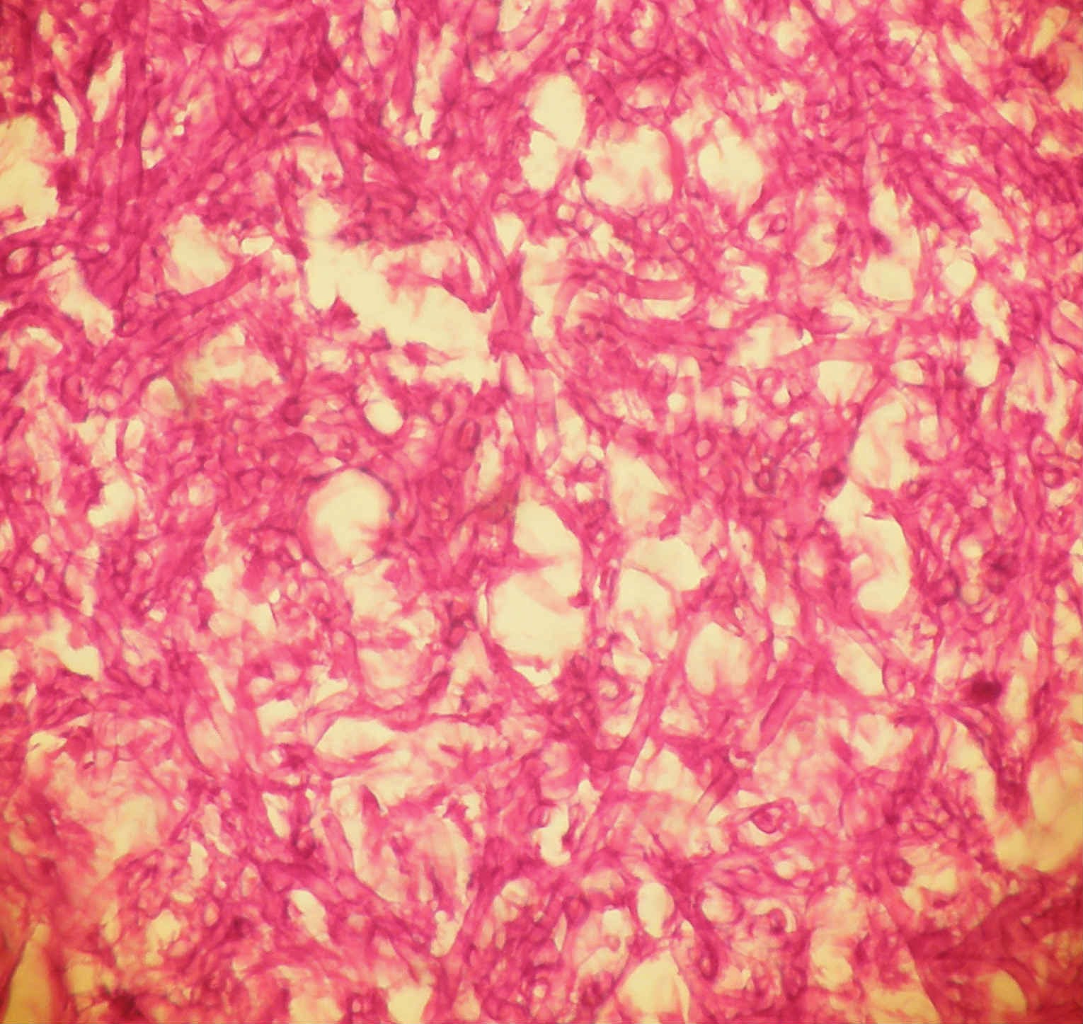 ATLAS MICOLOGIA: CONIDIOBOLUS CORONATUS