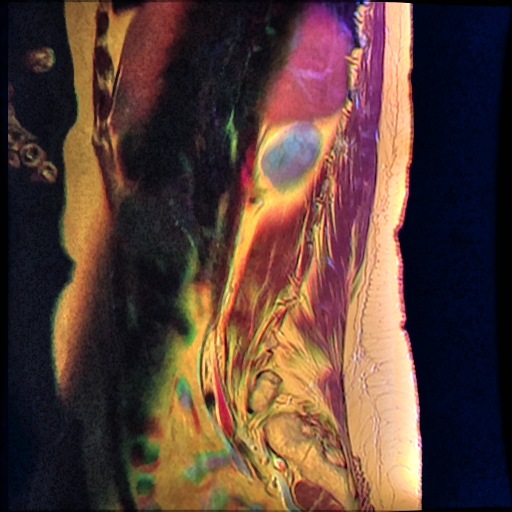 Nevit's blog: Color MRI of the Lumbar vertebrae