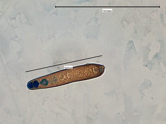 Fun With Microbiology (What's Buggin' You?): Exserohilum rostratum