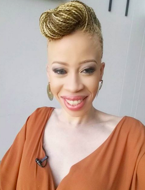 Sophie Mbeyu Blog: 12 Models With Albinism Who Are Taking The Fashion ...