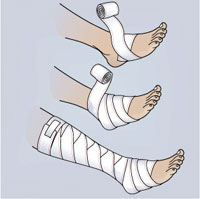 PRIMEROS AUXILIOS: Vendaje