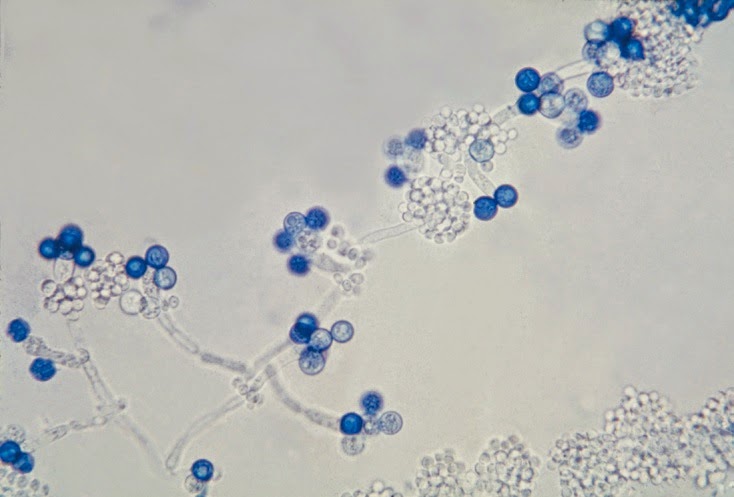 Introduction to Pathogenic Fungi and Superficial Mycoses | Tuyenlab