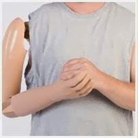 HitamPutihItuSama: Sekilas Mengenai Amputasi